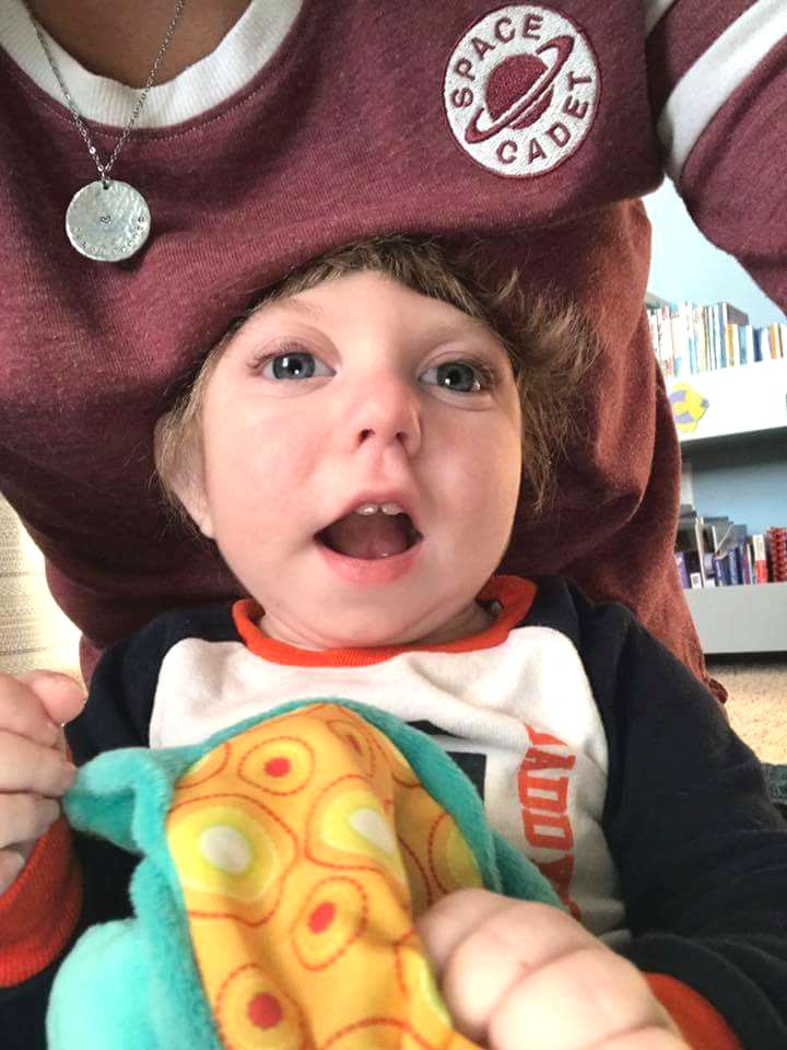 Miracle Baby Born With Missing Skull Defies Doctors' Predictions | FaithPot