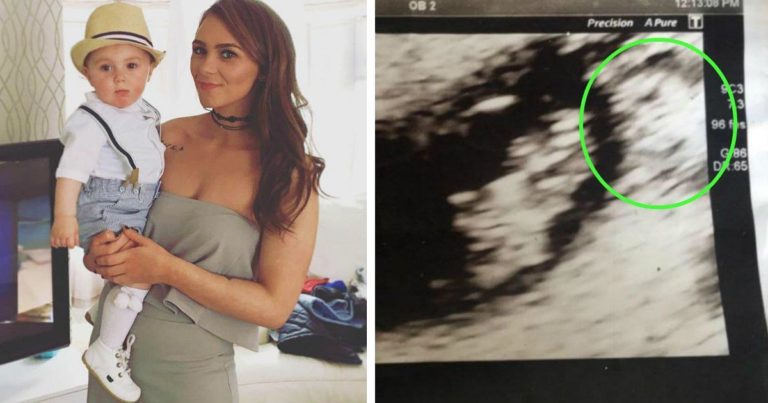 Mom Spots 'Guardian Angel' Granddad's Face In The Ultrasound During ...