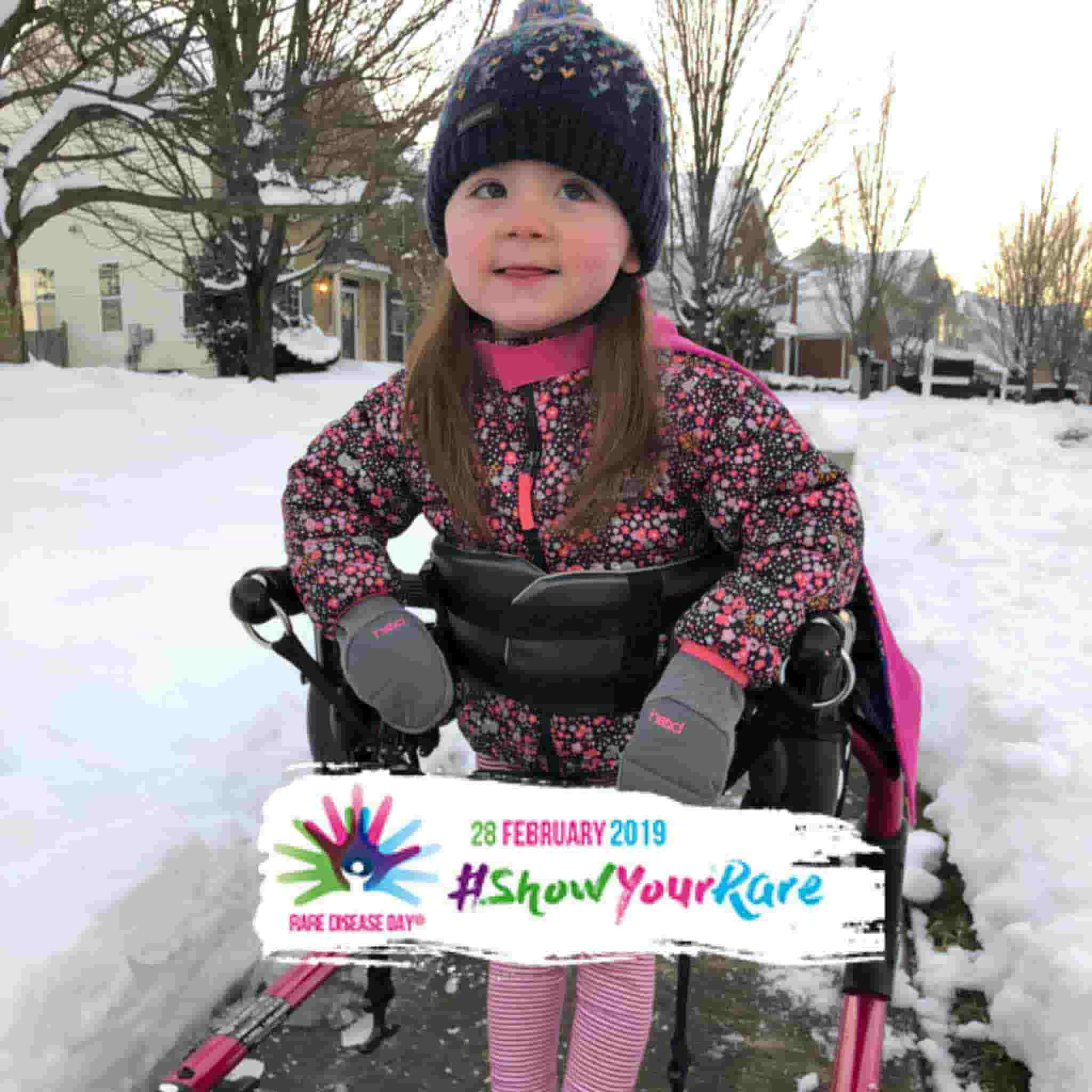 Girl With Rare Disease Left Spellbound On Seeing Ulta Beauty Ad ...