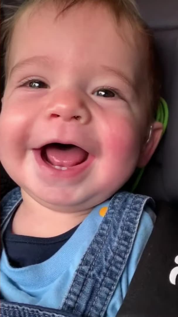 Deaf Baby Hears Mom's Voice For The First Time And Adorable Reaction ...