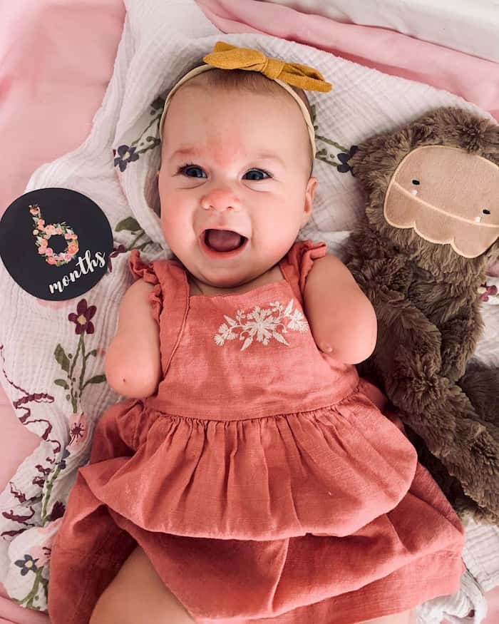 'She Is A Blessing': Mom Defies Doctors To Have Baby Without Arms And ...