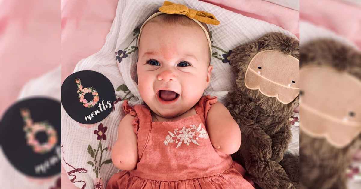 'She Is A Blessing': Mom Defies Doctors To Have Baby Without Arms And ...