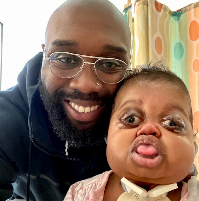Dad Writes Heartfelt Letters To Baby With Pfeiffer Syndrome
