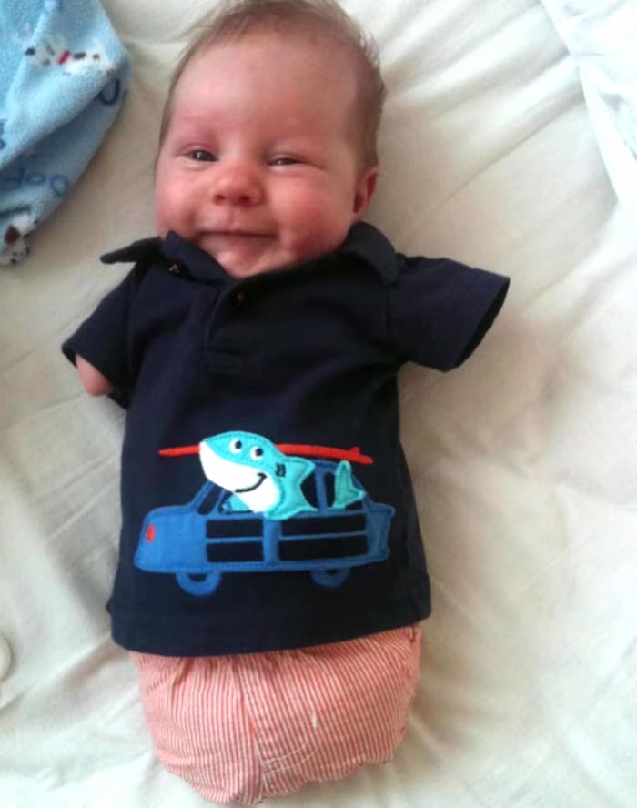 Young Woman Decides To Keep Her Baby With No Hands Or Legs, Now He's ...