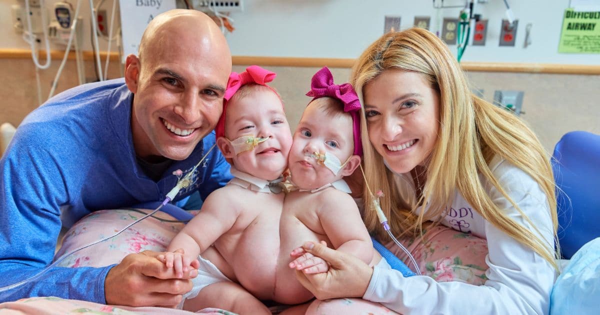 Parents Praise God After Conjoined Twins Are Successfully Separated In ...