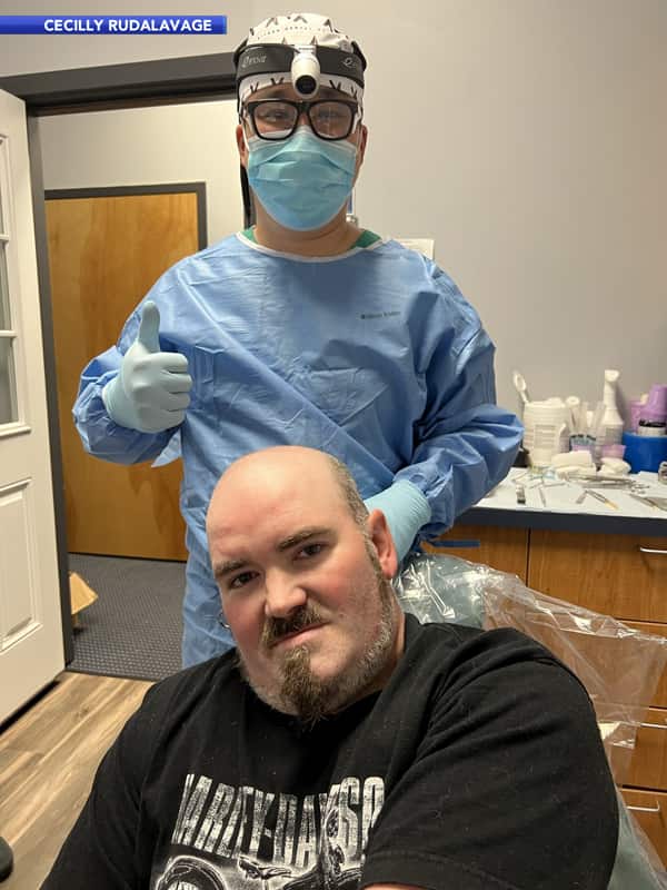 Man Who Was Shamed For His Smile Meets A Stranger In Car Crash And His ...