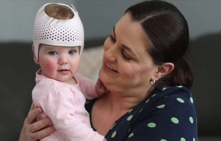 Baby Born with Tumor Double Her Body Weight Makes Miraculous Recovery ...